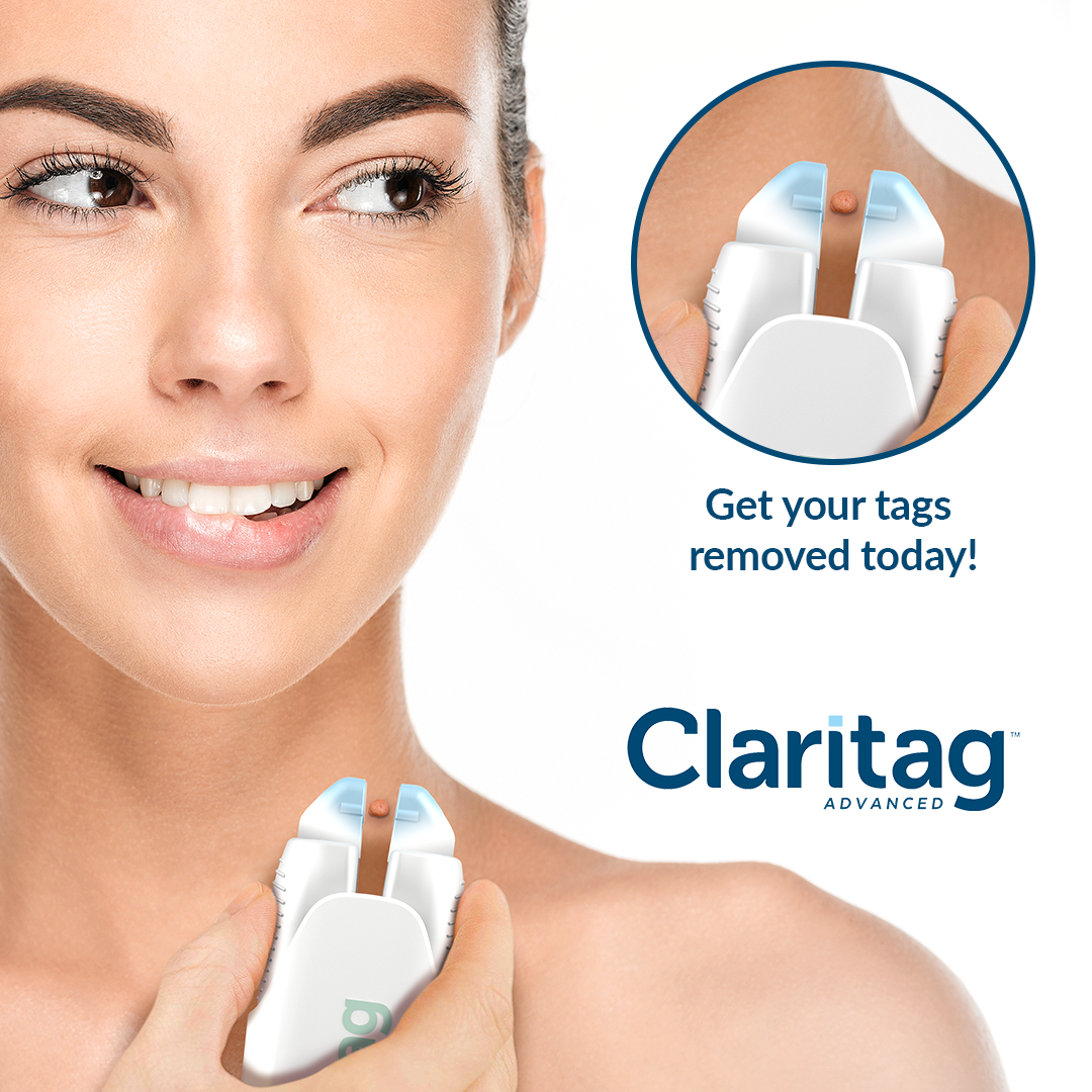 Claritag Advanced Skin Tag Remover, FDA-Cleared, 1 Treatment Cycle ...