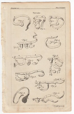 1764 THOMAS JEFFERYS Copper Engraving TRUSSES Surgical Device Hernia ...