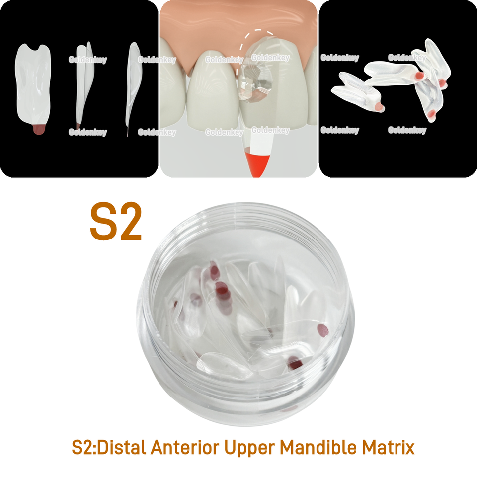Transparent Matrix Clear Dental Bow Matrice Band Anterior Front ...