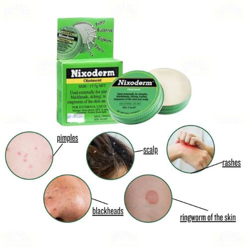 Nixoderm Ointment Eczema & Ringworm Skin Problems Acne Rashes Pimple 17 ...