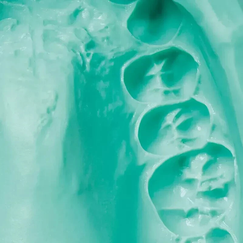 Zhermack Zetalgin Alginate Impression Material For Dental (free ...