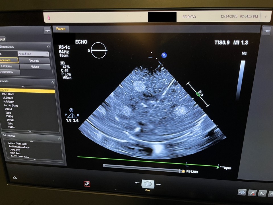 Philips X5-1c Ultrasound xMatrix Cardiac Transducer Probe | eBay