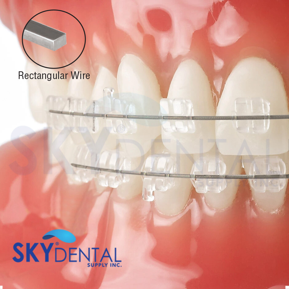 Natural Form Wires Ortho Dental Rectangular Archwire Top quality 100 ...