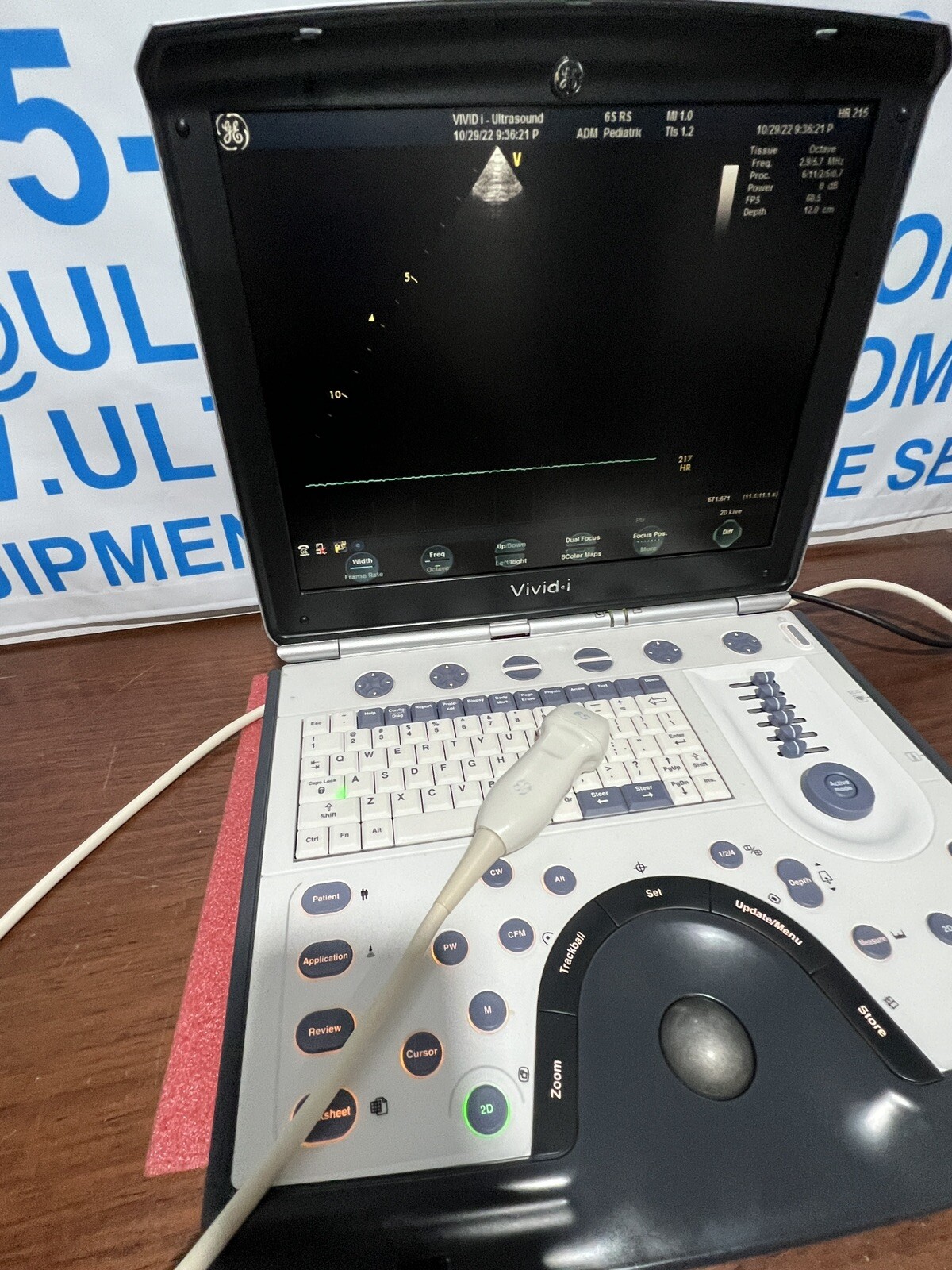 GE VIVID i Ultrasound with 6S-RS Cardiac Pediatric probes (READ THE ...