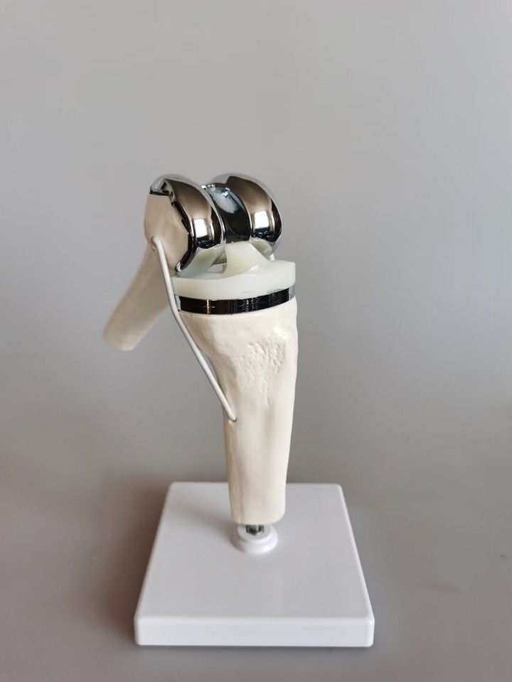 Detachable Artificial knee prosthesis Medical Anatomical Teaching demo ...