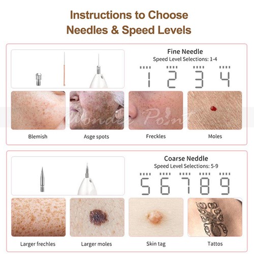Skin Tag Freckle Wart Dot Mole Remove Pen Dark Spot Tattoo Removal ...
