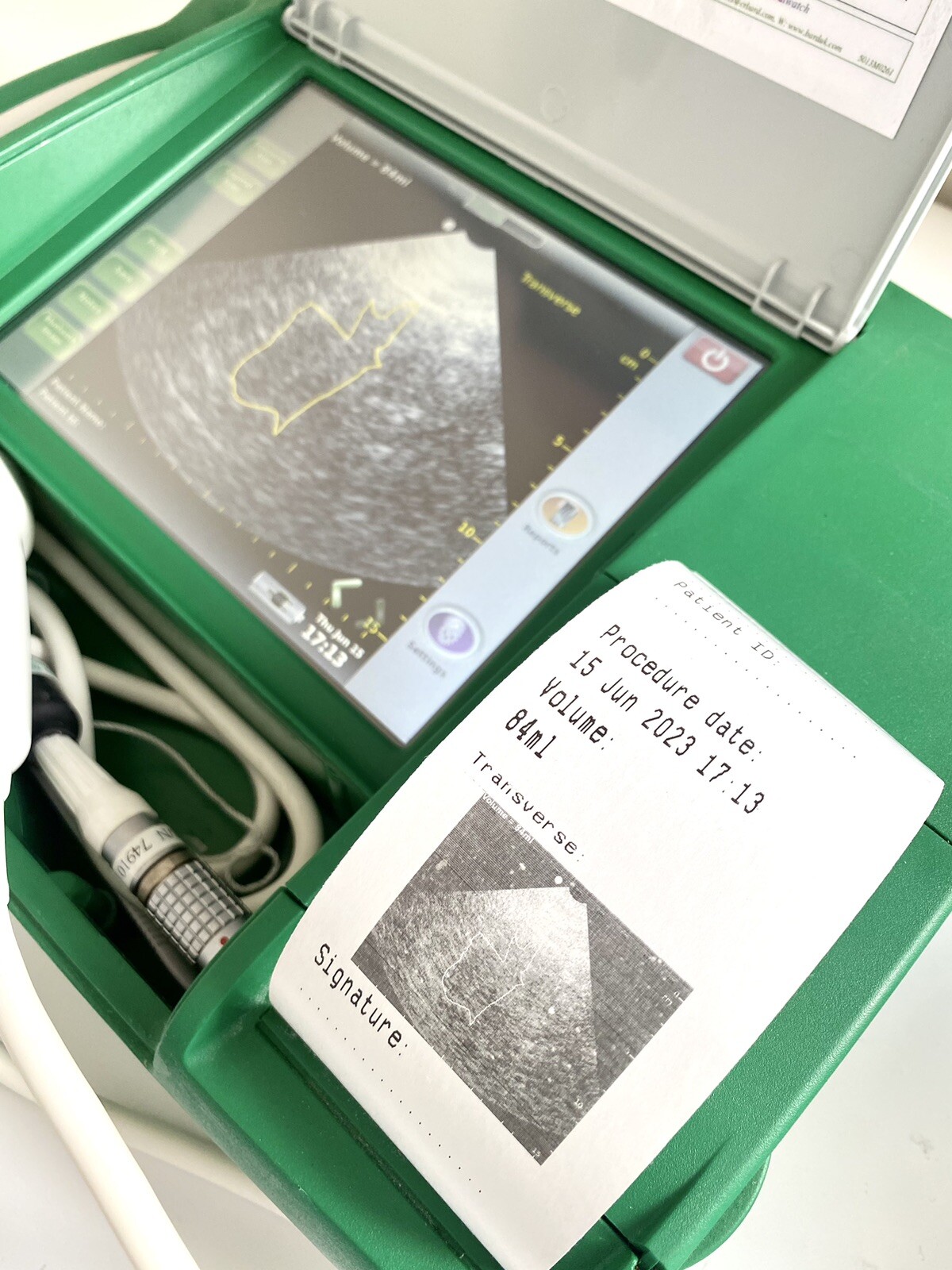 BARDSCAN IIs TOUCHSCREEN ULTRASOUND BLADDER SCANNER UROLOGY + GEL | eBay