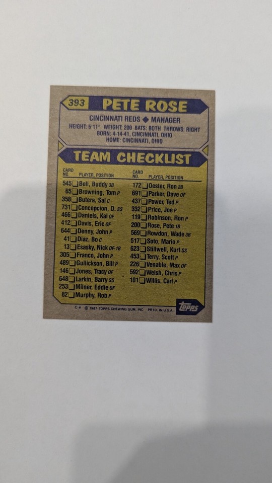 1987 Topps Pete Rose #383 ERROR CARD (3 ERRORS) - SEE PICTURES | eBay