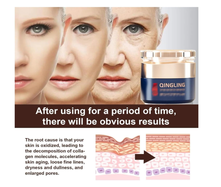 1 Pack Qingling Crema para Arrugas Qingling Wrinkle Removal Cream ...