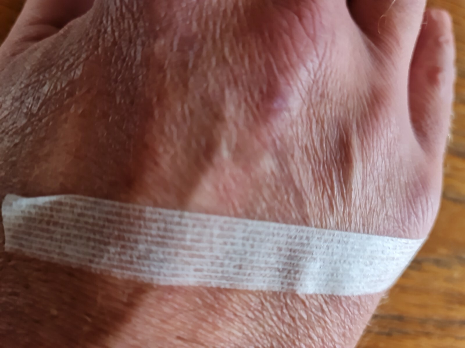 3M Steri-Strip Reinforced Skin Wound Closures / Paper Stitches 12x100mm ...