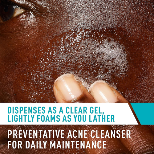 CeraVe Acne Foaming Cream Cleanser | 2% Salicylic Acid, 8 Ounce ...