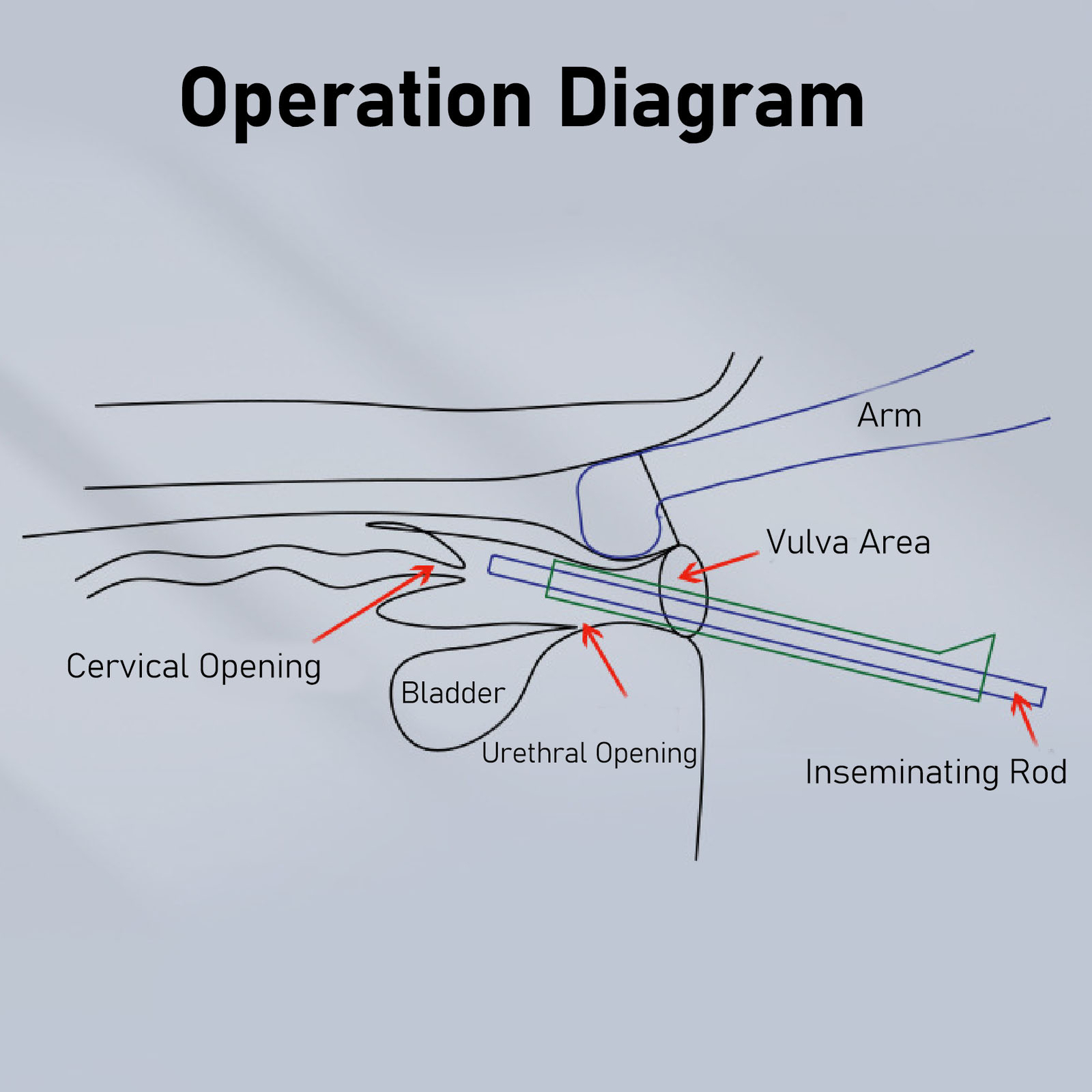 304 Stainless Steel Cow Artificial Inseminating Rod Animal Breeding ...