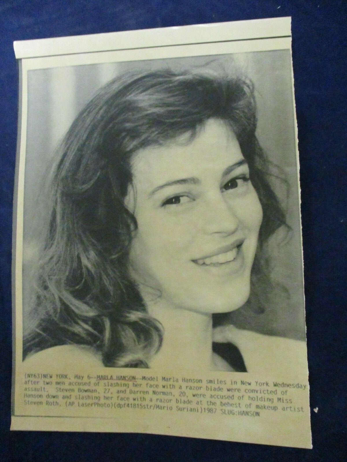 1987 Model Marla Hanson victim of NY attack #2 Vintage Wire Press Photo ...