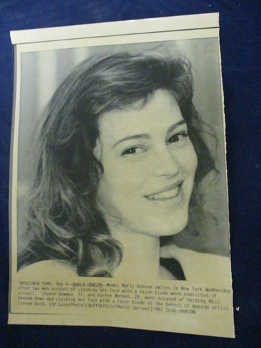 1987 Model Marla Hanson victim of NY attack #2 Vintage Wire Press Photo ...