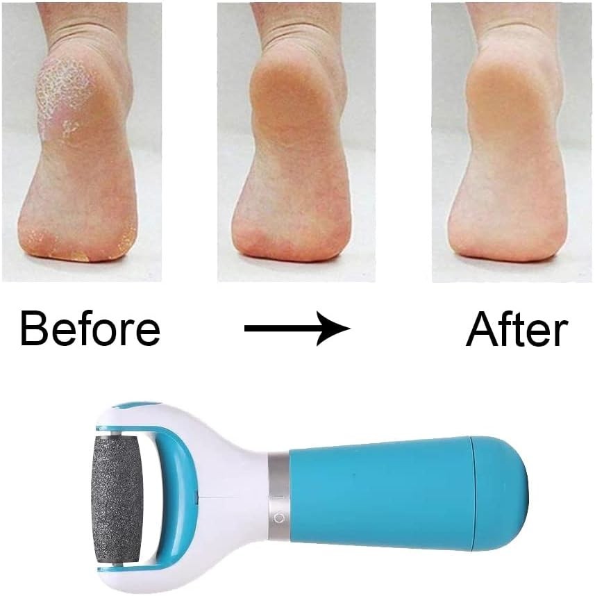 Callus Removal for Silky Soft Feet, Electric Callus Remover Quick ...