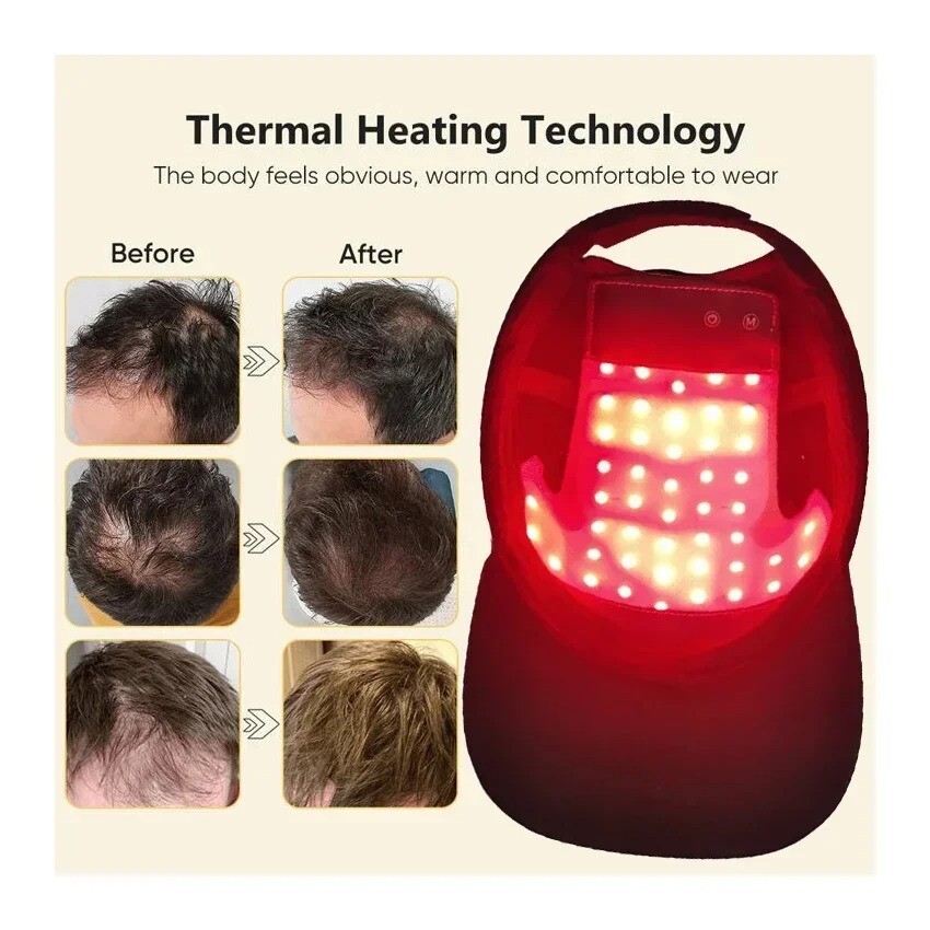 LED Red Light Therapy Hair Growth Cap Fast Regrowth Anti Hair Loss Hat ...