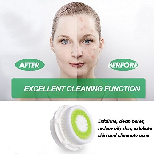 NORMAL + ACNE Facial Brush Head Replacements Mia Aria Smart Fits All ...