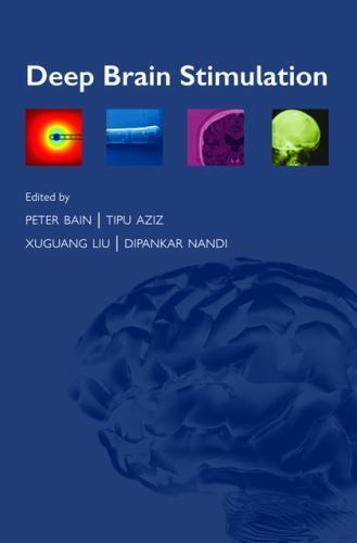 Deep Brain Stimulation by Tipu Aziz (2009, Trade Paperback) for sale ...