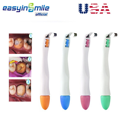 50pcs Dental Pro Matrix Bands Adjust Retainer 4.5/6 MM Curved/Standard ...