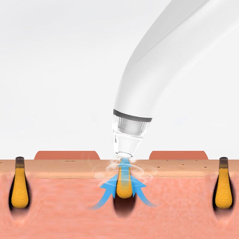 Electric Blackhead Remover Cleaner Face Diamond Pore Vacuum Suction ...