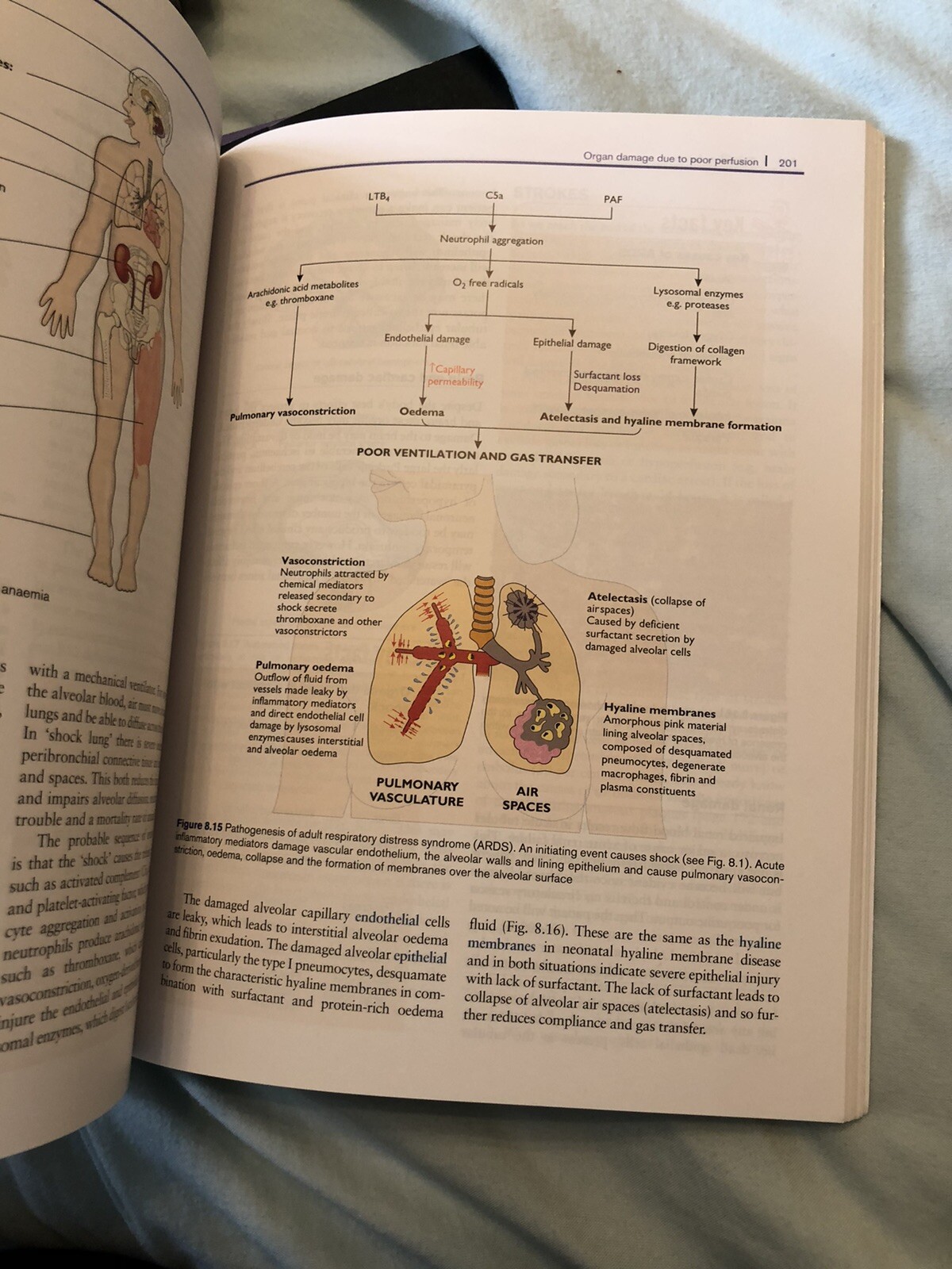 Basic Pathology : An Introduction to the Mechanisms of Disease by Susan ...