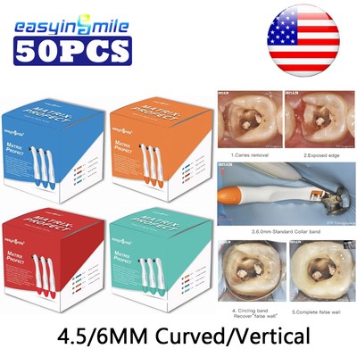 Standard/Curved Dental Pro Matrix Band Pre-formed Interproximal ...