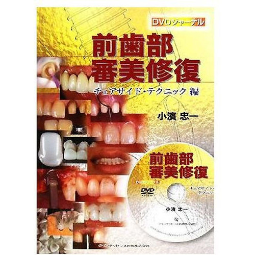 Front Teeth Aesthetic Restoration Chair Side Technique Edition DVD Used ...