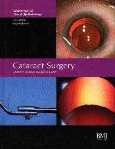 Fundamentals of Clinical Opthalmology Ser.: Cataract Surgery by Jack ...