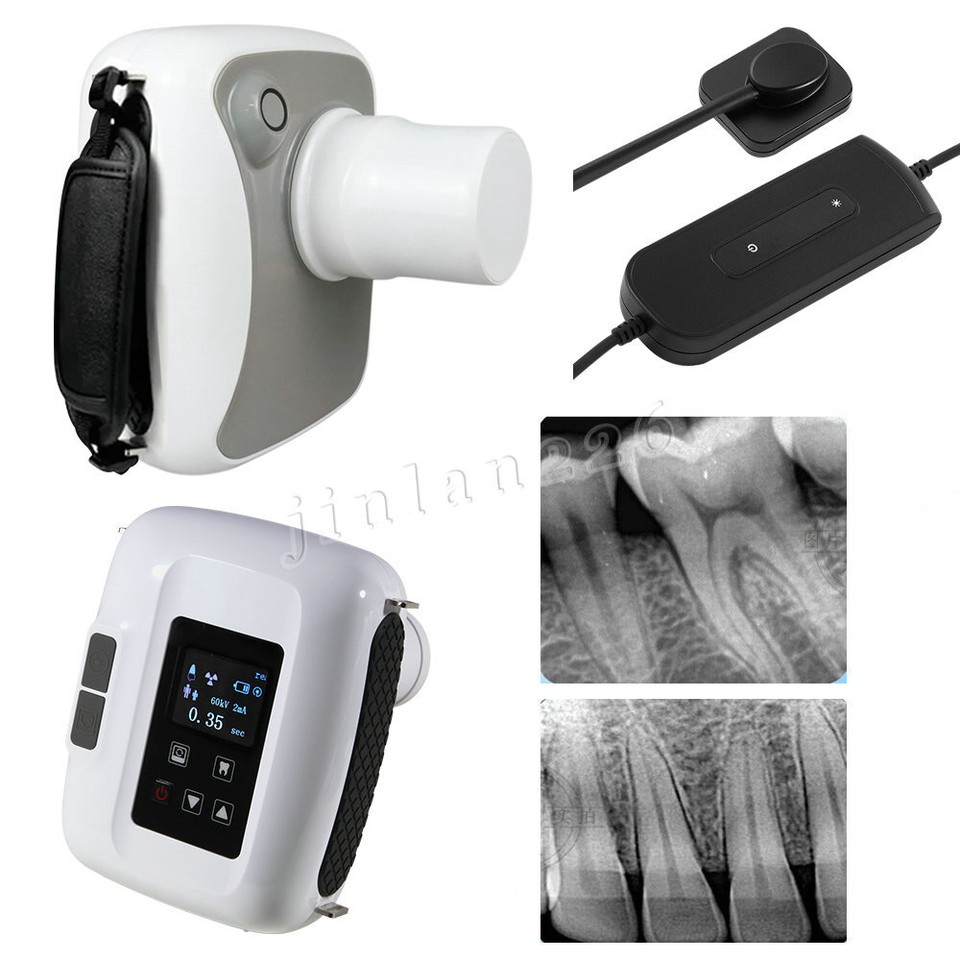 Digital X-Ray Sensors Dental RVG Sensor Intraoral Xray Imaging System 1 ...