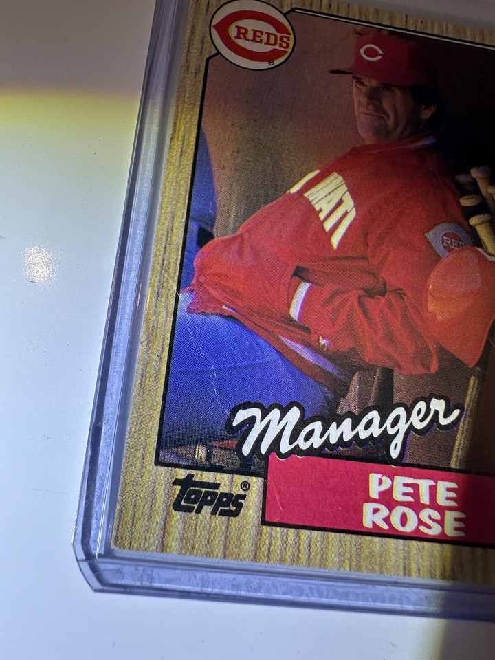1987 Topps 393 Pete Rose Manager Card with Errors - Extremely Rare | eBay