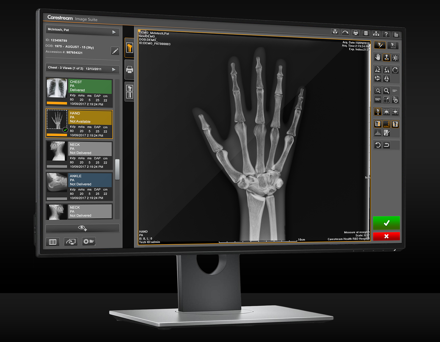 xray cr reader carestream Vita CR - Digital X-Ray | eBay