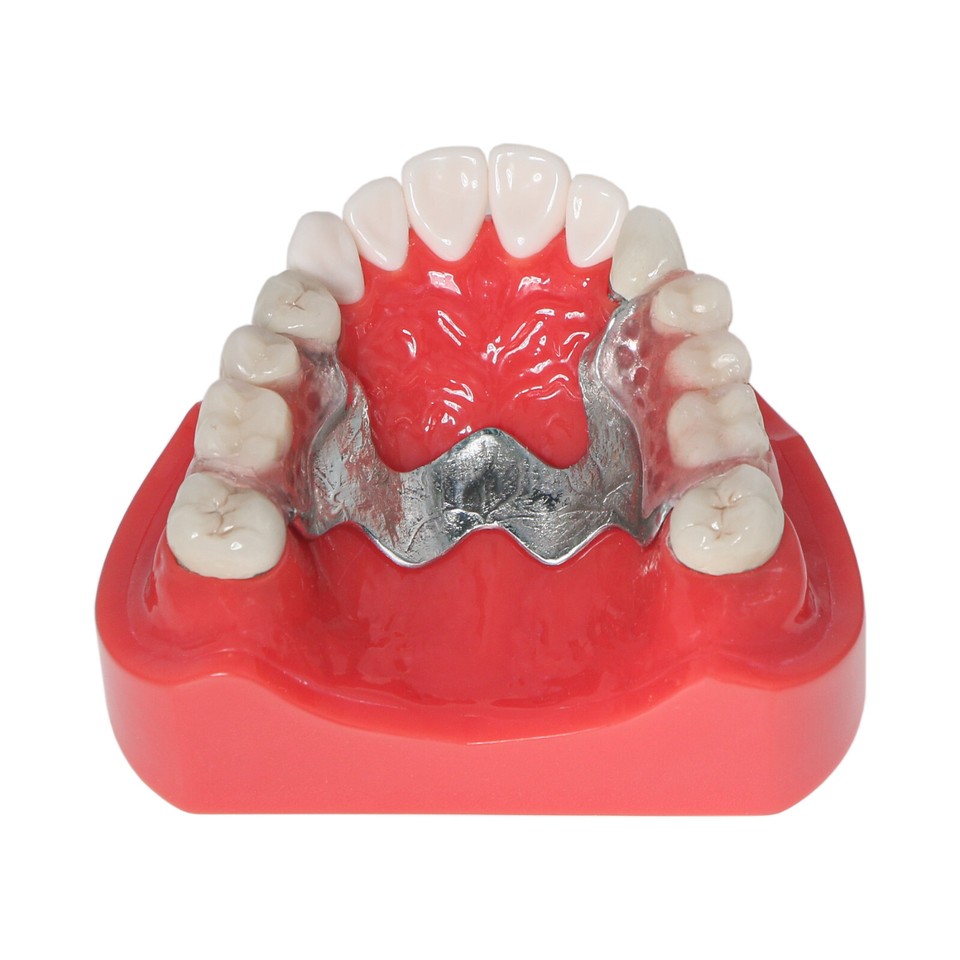 Dental Crown Restoration Model Demo With Partial Denture Teeth ...