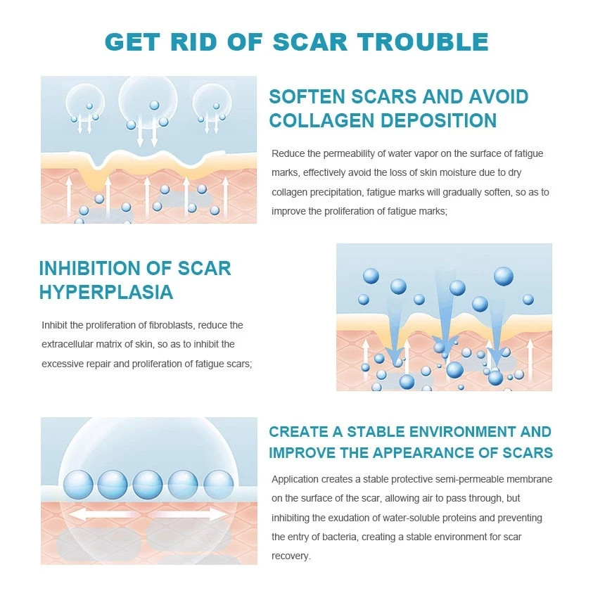LaneMay Scar Repair Cream Desalinating Scar, Stretch Marks Cold ...
