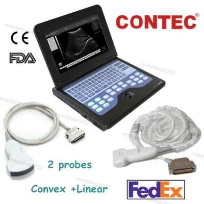 Portable Ultrasound Machine Laptop B-Ultrasound Scanner Linear Convex 2 ...