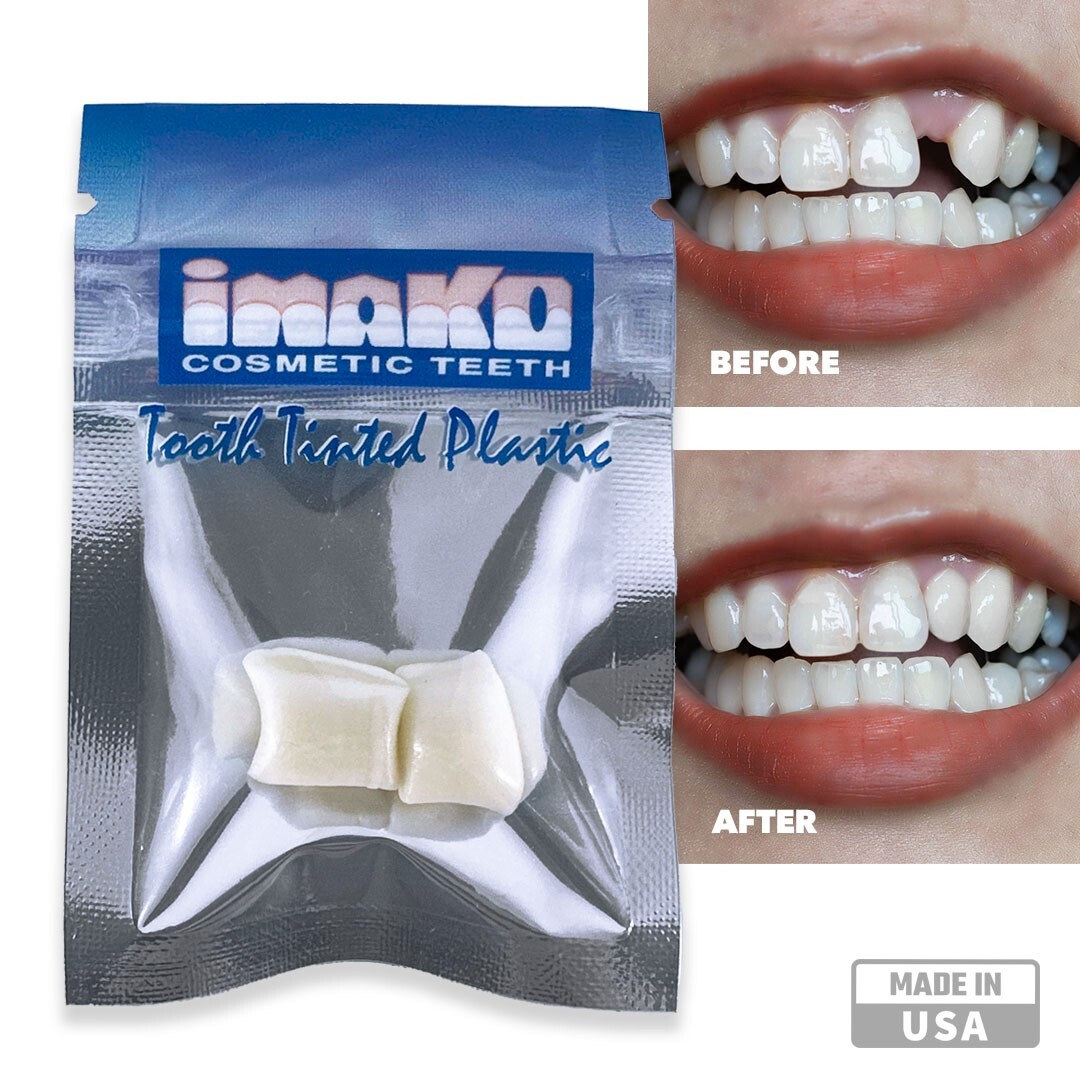 Imako® Tooth Tinted Plastic - Temporary Tooth - Fix Chipped Teeth, Gaps ...