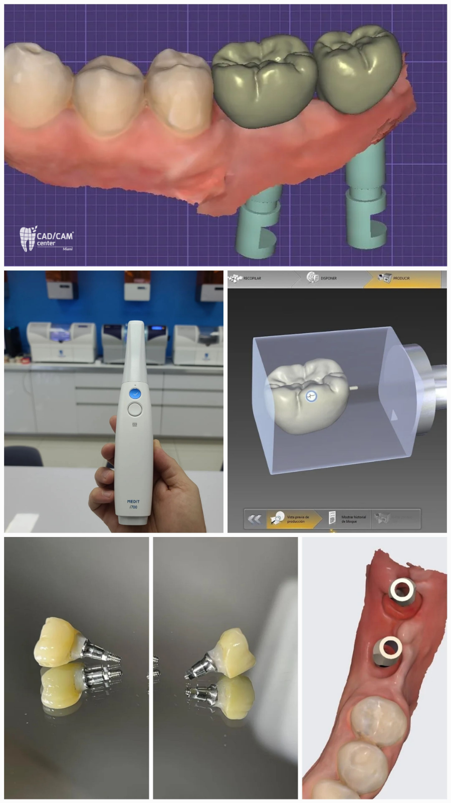 Medit i700 + SIRONA CEREC MCXL + Ivoclar CS Oven - Chairside System | eBay