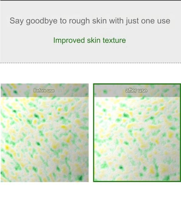 VT Cica Reedle Shot 100 50ml for Acne Blemish for Skin Texture K-Beauty ...