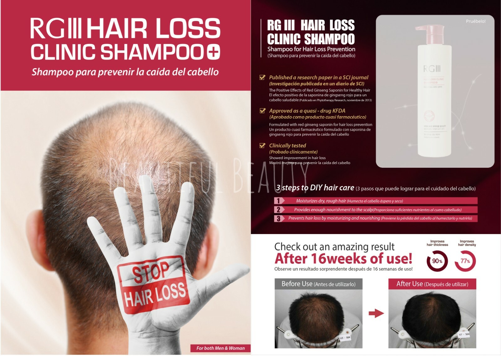 RGIII RG3 Hair Regeneration Hair loss prevention Hair regrowth Clinic ...