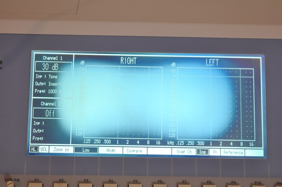 Interacoustics AC40 Clinical Audiometer | eBay
