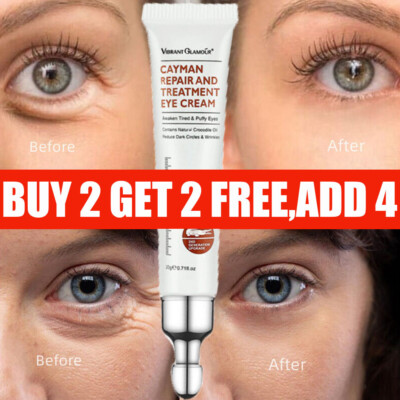 Magic Eye Cream 28 Seconds Remove Eye Bags Dark Circles Eye Wrinkles ...
