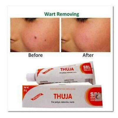 SBL THUJA HOMEOPATHIC Cream 25 gm Warts, Polypus, corns, brown spots ...