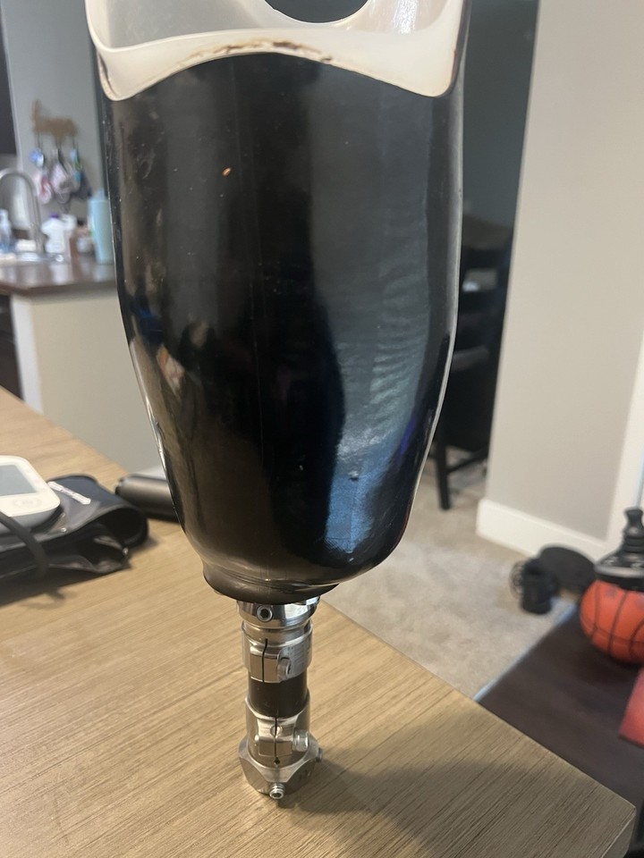 Prosthetic Left Leg Socket | eBay