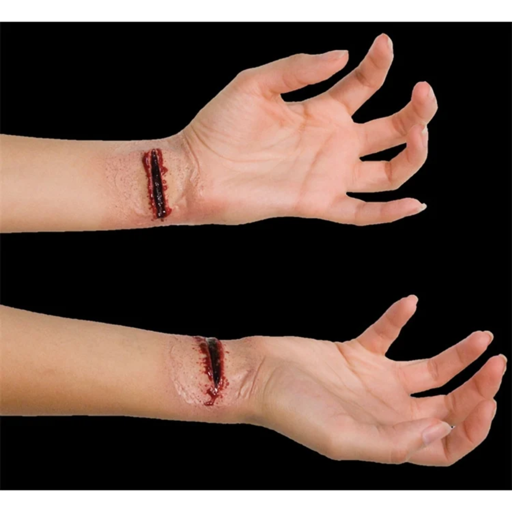 Slit Wrists Stitches Flexor Tendon Injuries OrthoInfo AAOS