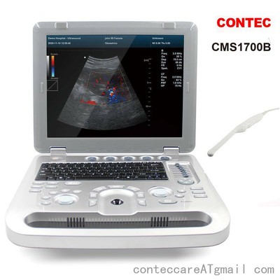 Imaging & Aesthetics Equipment - Transrectal Probe