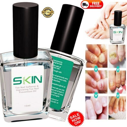 Toe Nail Softener oil Ingrown Toenail Treatment Oil for Hard Thick Nail ...