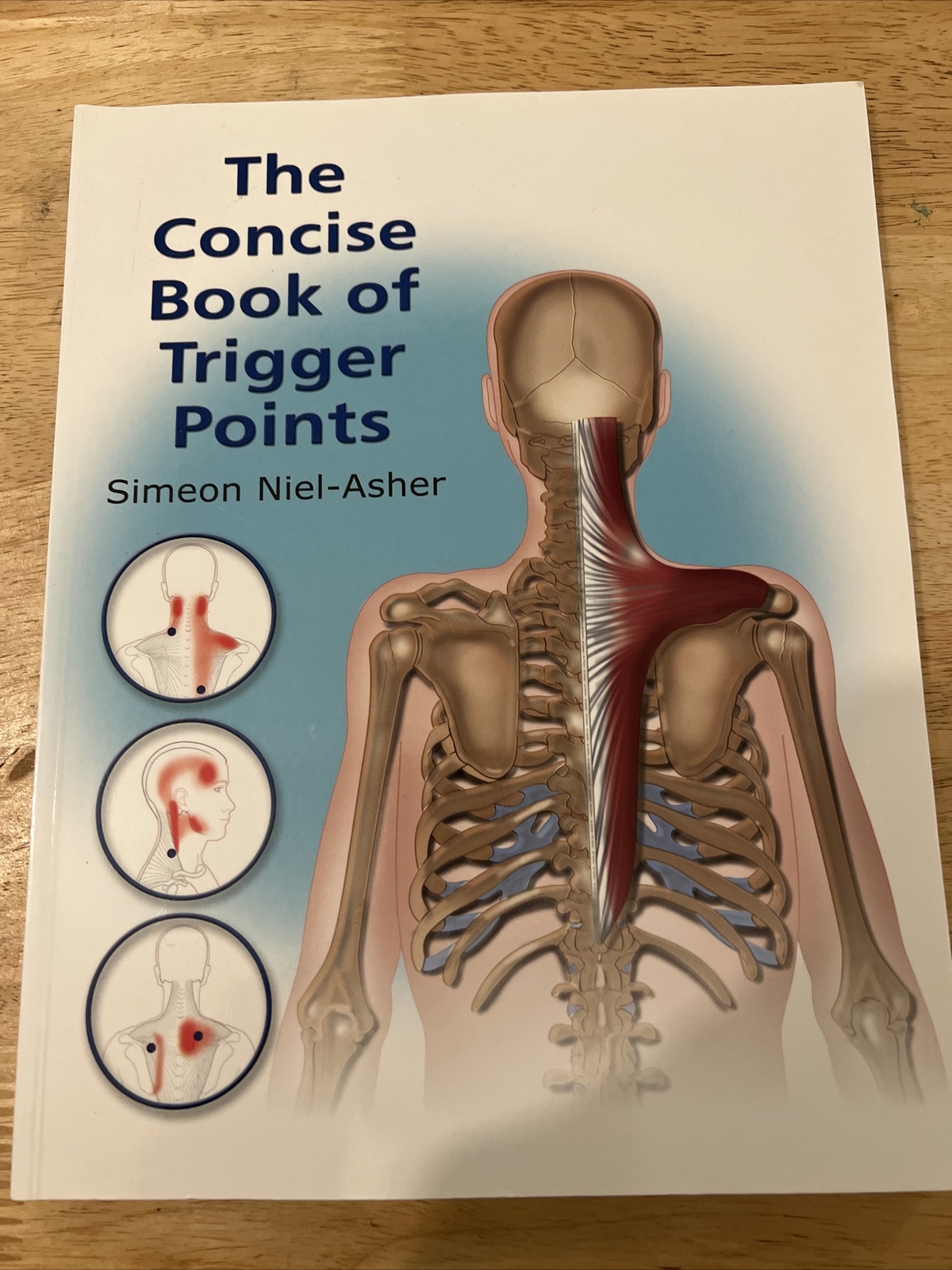 Concise Book of Trigger Points by Simeon Niel-Asher (2006, Trade ...