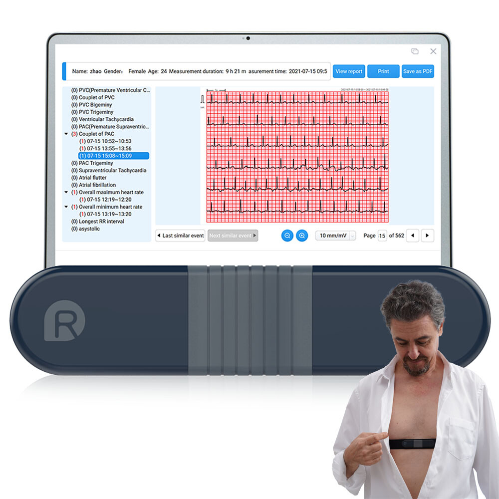 AI Holter Monitor 24 Hrs Chest Strap EKG Monitor with Free AI Analysis ...