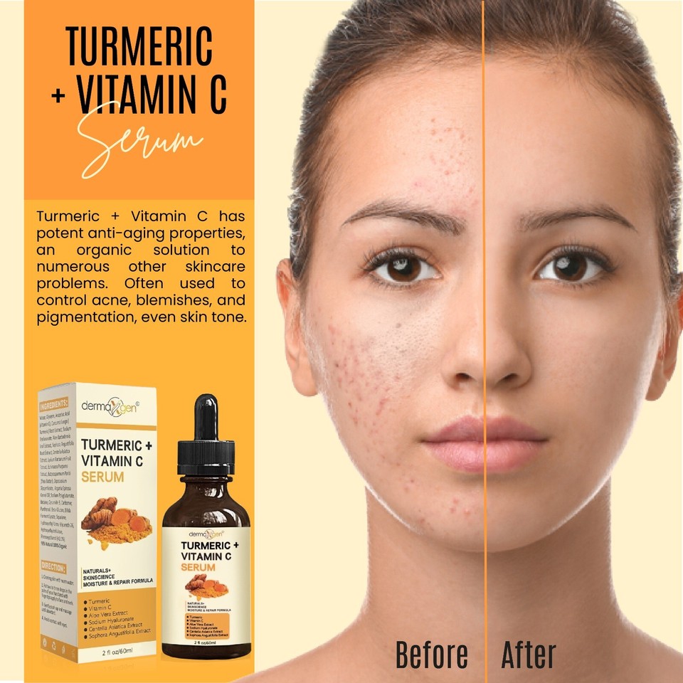 2 FL OZ -TURMERIC FACE SERUM + PIGMENTATION+BLEMISH CORRECTOR+DARK ...