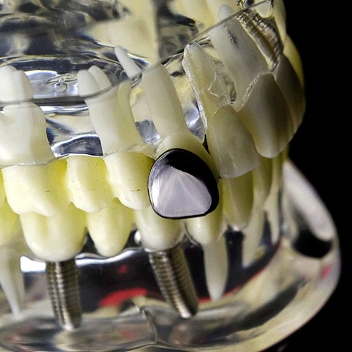Black Single Cap Tooth Grill Plain Canine Slug Teeth Rapper Hip Hop ...