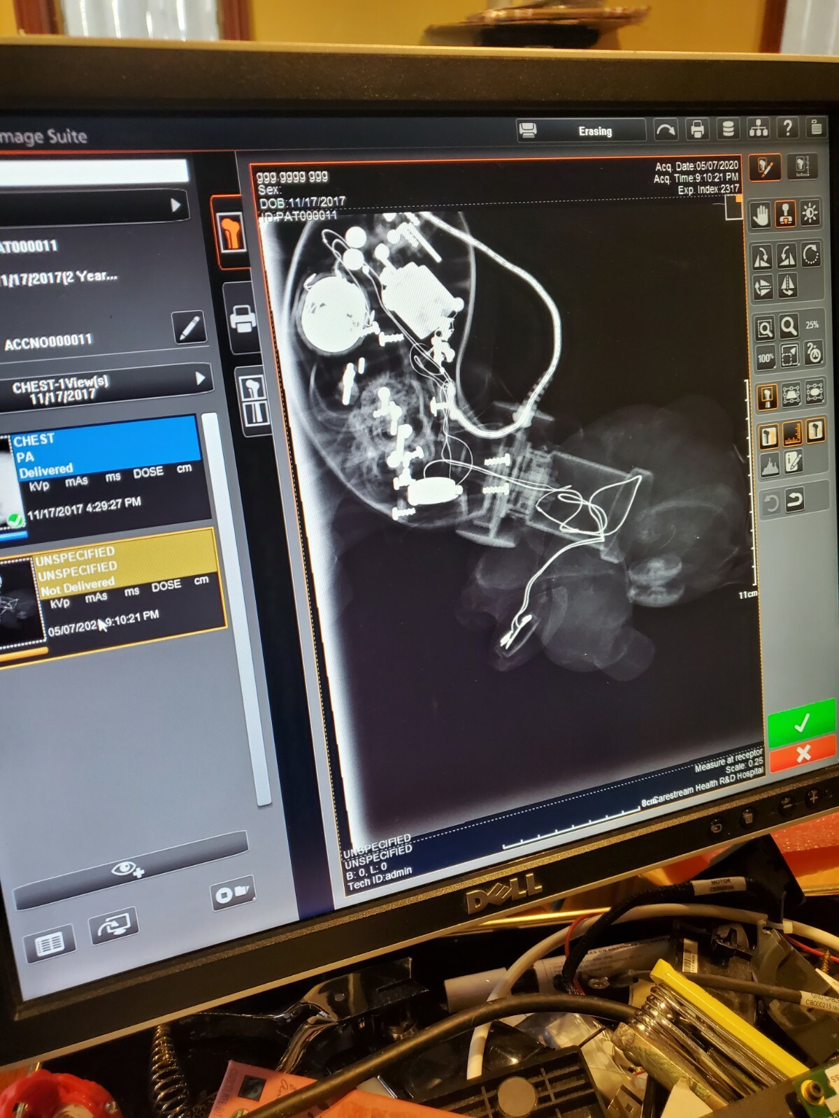 digital xray CR reader carestream 80lbs | eBay